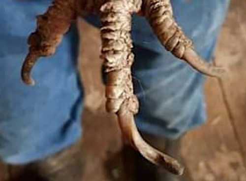 What is wrong with my chickens feet? - Cluckin