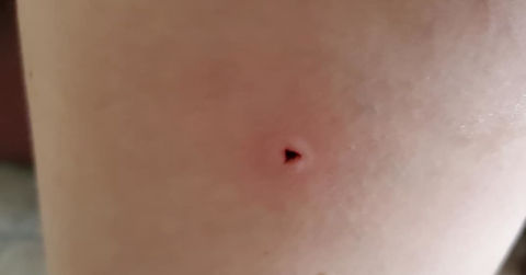 Which diseases can humans catch from chickens and how to protect ...