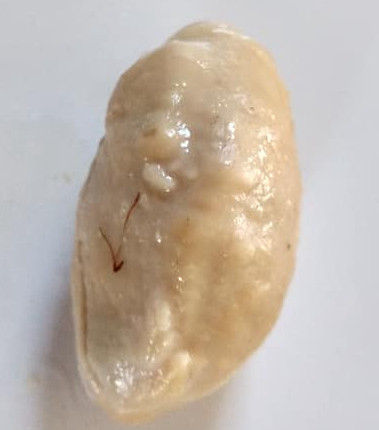 Lash Eggs, Salpingitis or Egg Lash Disease in chickens - Cluckin